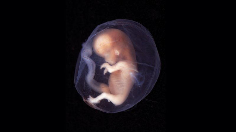 CRISPR Gene Editing Causes Havoc in Embryos - Sustainable Pulse