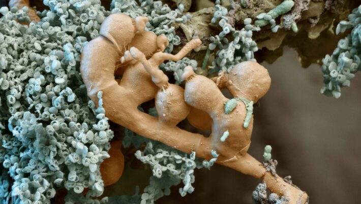 GMO Soil Microbes Threaten Regenerative Agriculture and Environmental ...