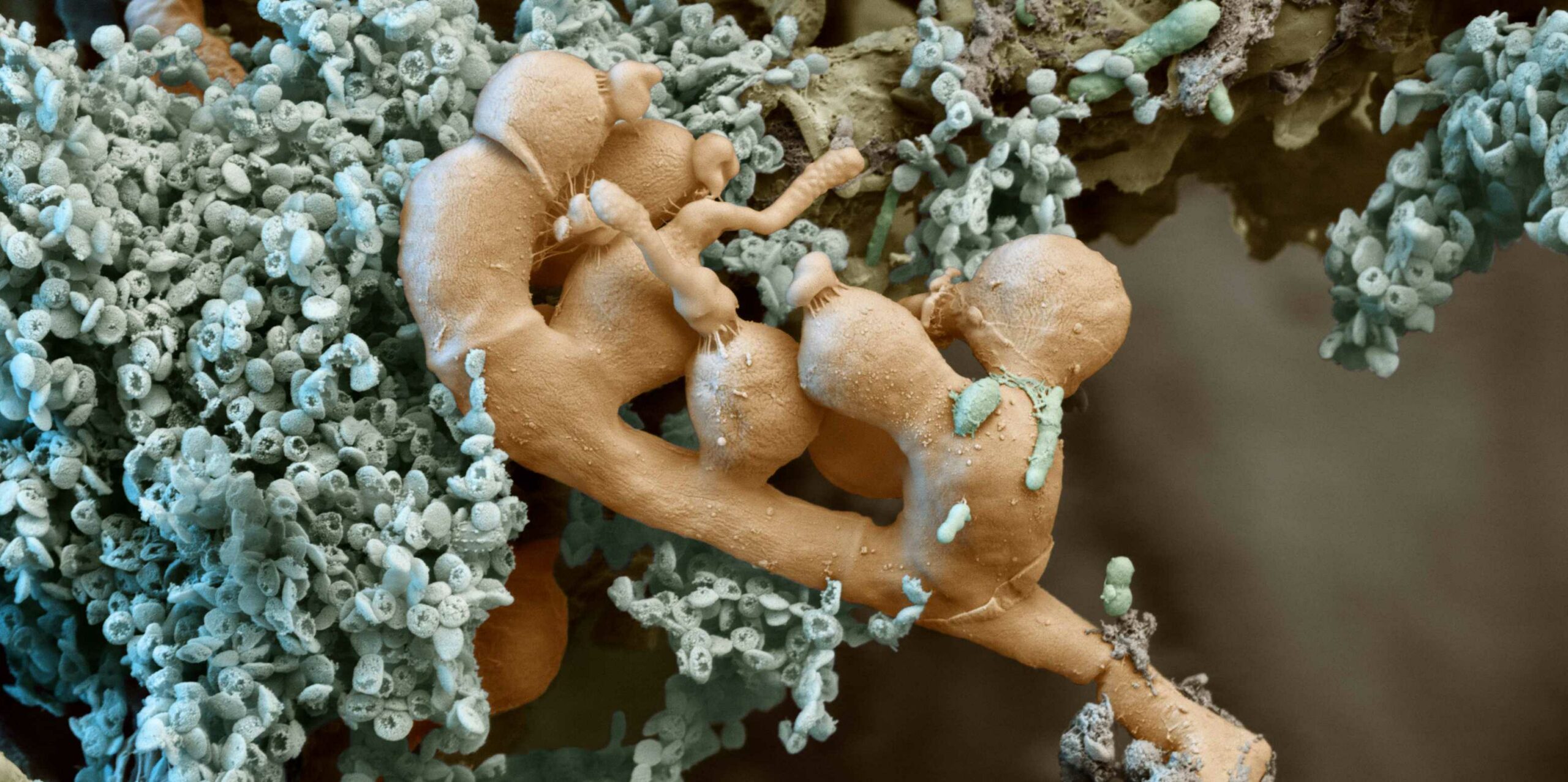 GMO Soil Microbes Threaten Regenerative Agriculture and Environmental ...